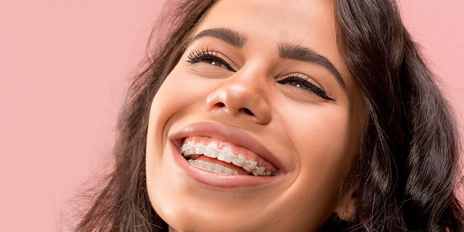 Clear Braces in Monrovia | Hwang Orthodontics